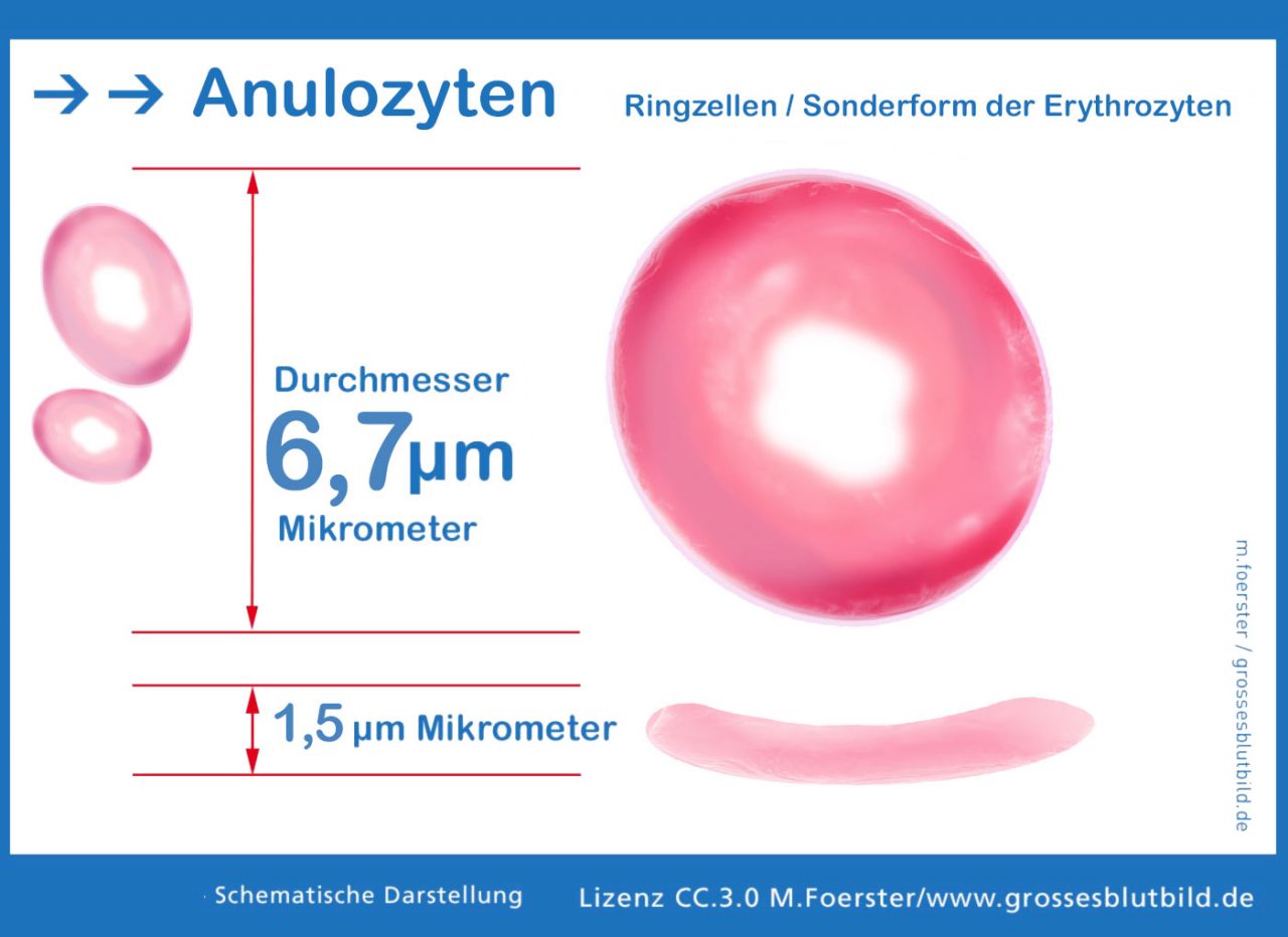 Infografiken zu Hämatologie und Blut » Fotokunstweb.de