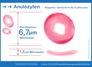 Anulozyten im Blutbild » Fotokunstweb.de